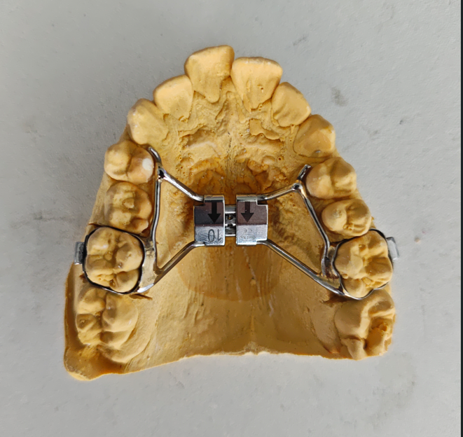 Quality Biocompatible and Clinically Proven Dental Expander - Custom-fitted Maxillary for sale