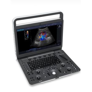 Quality 15.6inch LED Sonoscape E1 Exp Ultrasound Machine BW Ultrasound for sale