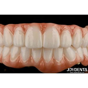Quality Long Lasting Titanium Bar Zirconia Hybrid Bridge Natural Looking Aesthetics For for sale