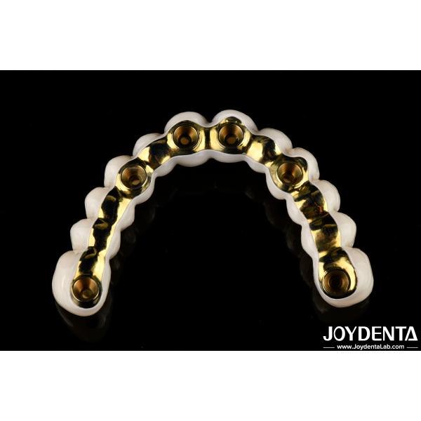 Quality Smooth Hybrid Zirconia Implant Bridge Restoring Chewing Function Custom Made for sale
