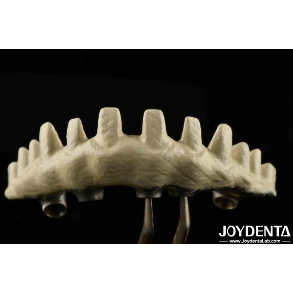 Quality Internal Hex Connection Type Custom Implant Abutments Sandblasted And Acid-etched For Superior Fit for sale