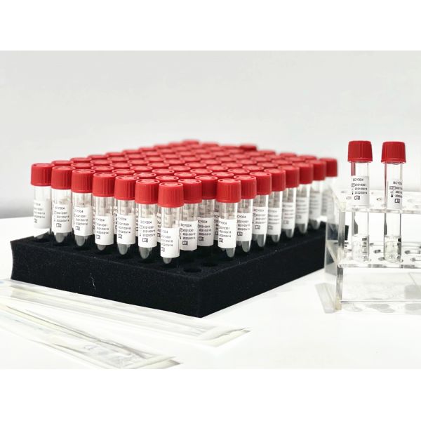 Quality One Step Sample Release Reagent PCR Extraction Kit From Patient Pharynx Swab for sale