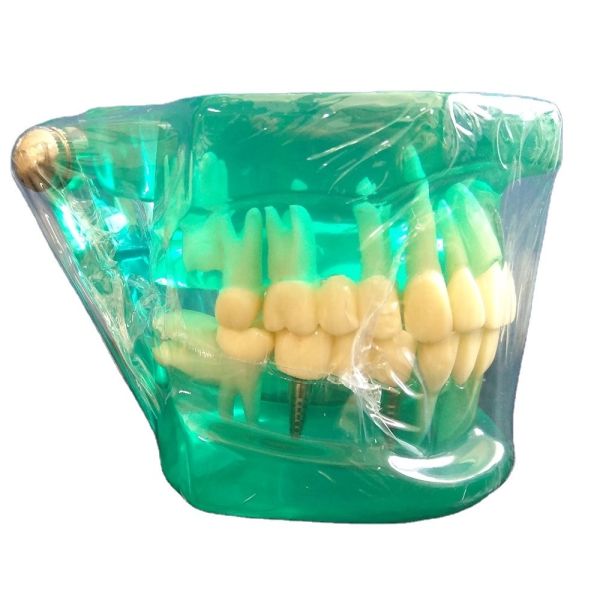 Quality DTC Orthodontic Dental Typodont Brackets Model Custom Made for Manual and OEM for sale