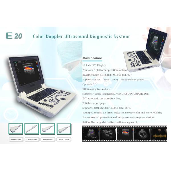 Quality OEM Hospital Ultrasonic Diagnostic Instrument 120GB Ultrasound Medical Equipment for sale