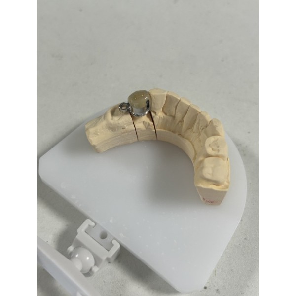 Quality ERA Precision Dental Attachment for High-Accuracy Dental Applications for sale