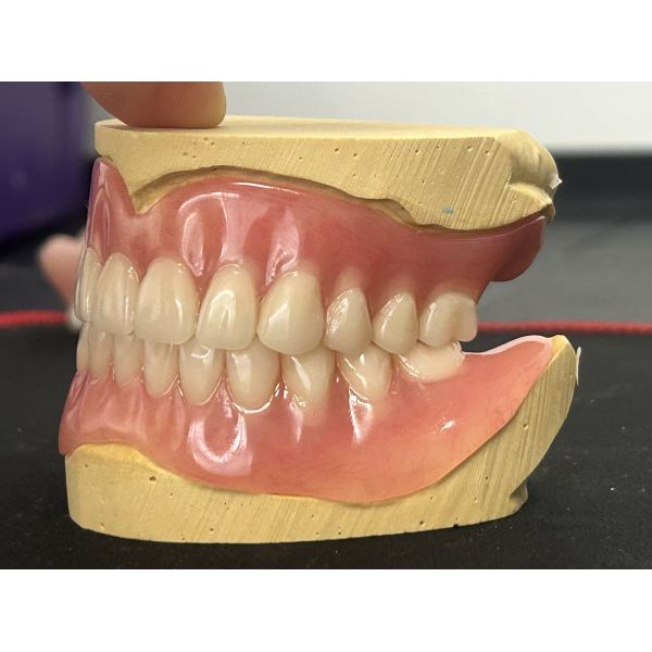 Quality Custom Full Denture with Natural Appearance and Comfortable Fit for Complete for sale