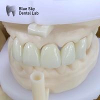 Quality Natural Esthetics Multi Layered Zirconia Crown High Strength Chemical Resistance for sale