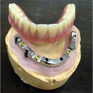 Quality High Biological Inter Miscibility Denture Dental Lab Safety Implant for sale