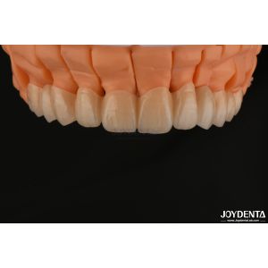 Quality High Aesthetics Layered Zirconia Single Crowns Bridges Implant for Dental for sale