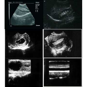 Quality Portable Ultrasound Scanner Color Doppler Machine With 15 Inch LCD Monitor for sale