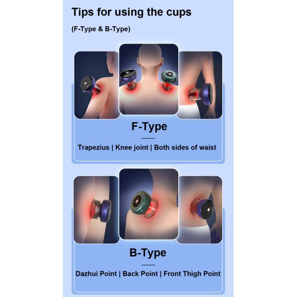 Quality Customized Hijama Cupping Set Cupping Therapy Massager for Fitdash F-Type for sale