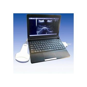 Quality Mobile Ultrasound Machine Digital Laptop Ultrasound Scanner with 100 Frames for sale