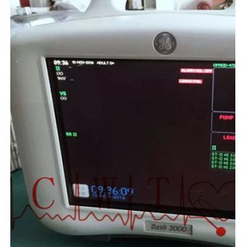 Quality 12.1 Inch 5 Parameter Patient Monitor , Dash3000 Healthcare Monitoring System for sale