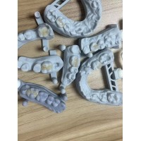 Quality Emax Inlay and Onlay Dental Restoration with Natural Teeth Color, Minimal for sale