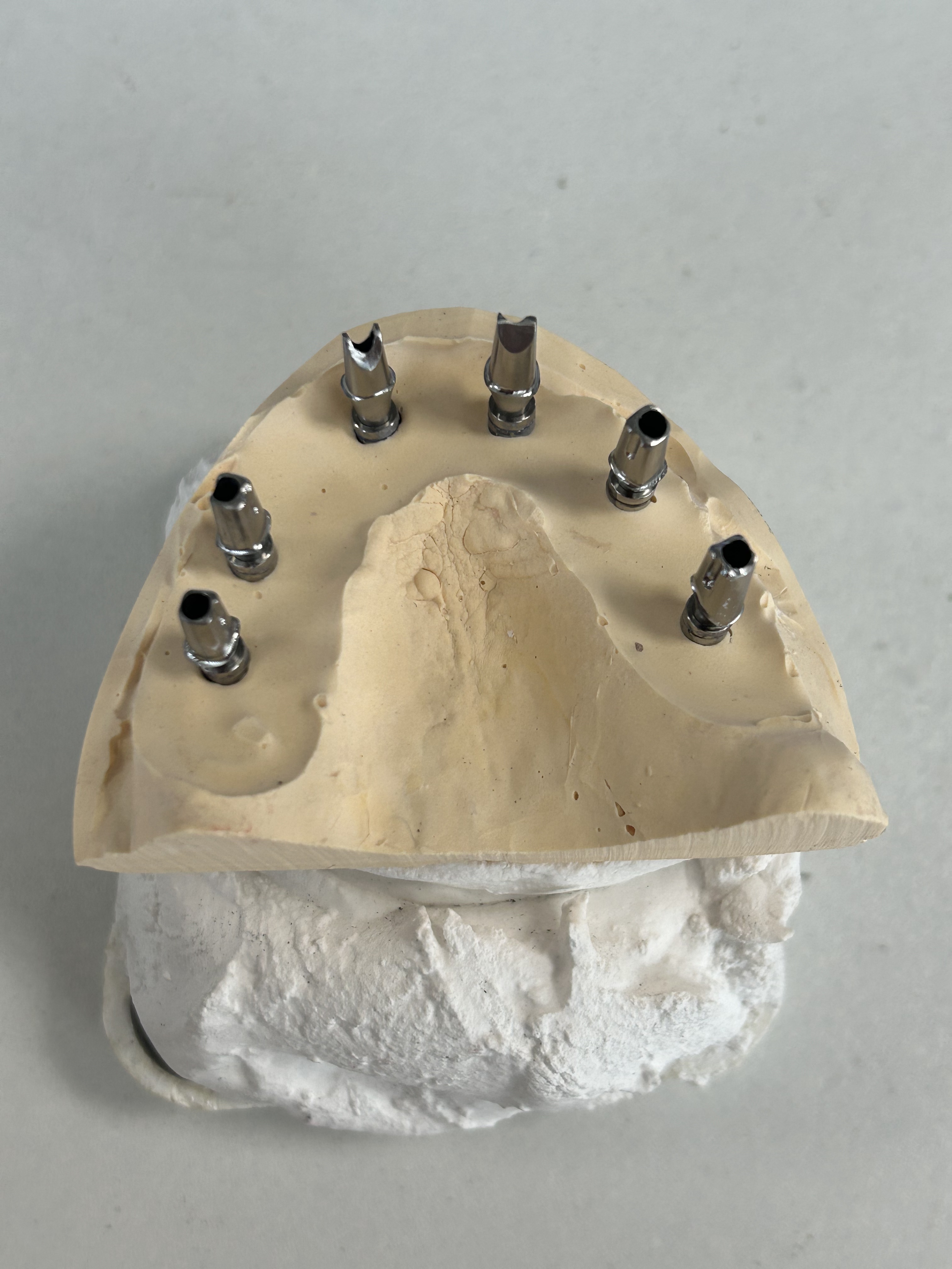 Quality High Strength Cobalt Chrome Implant Denture with Corrosion Resistance and Biocompatible Co-Cr Alloy for sale