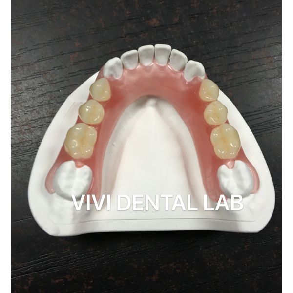 High Esthetics Flexible Acrylic Partial Denture / Valplast Dental ...