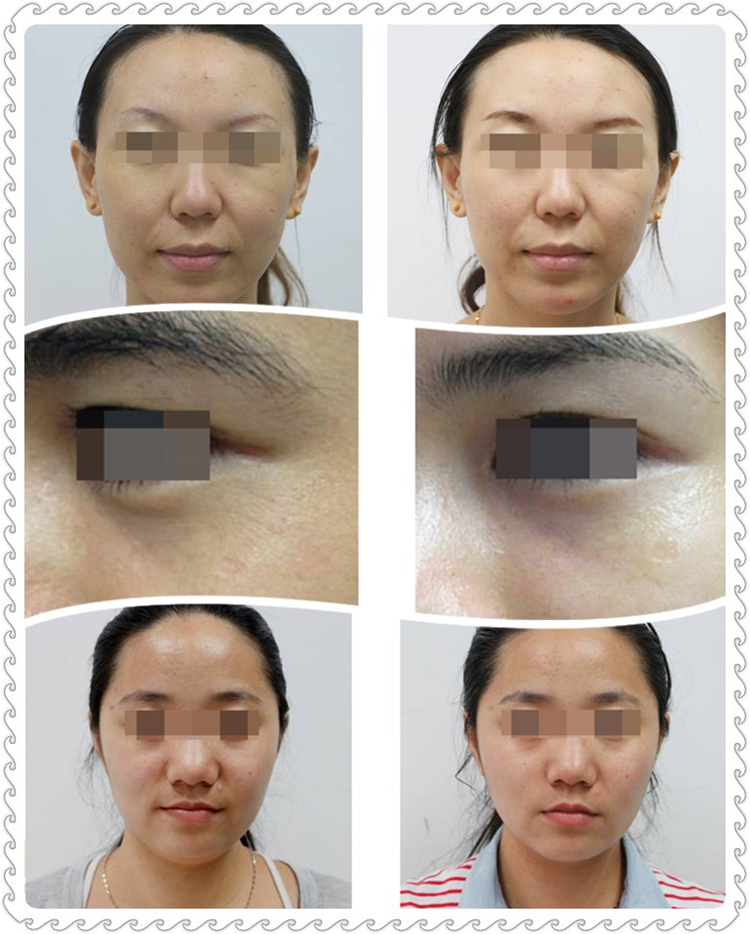  Microcurrent face lifting home beauty equipment.jpg