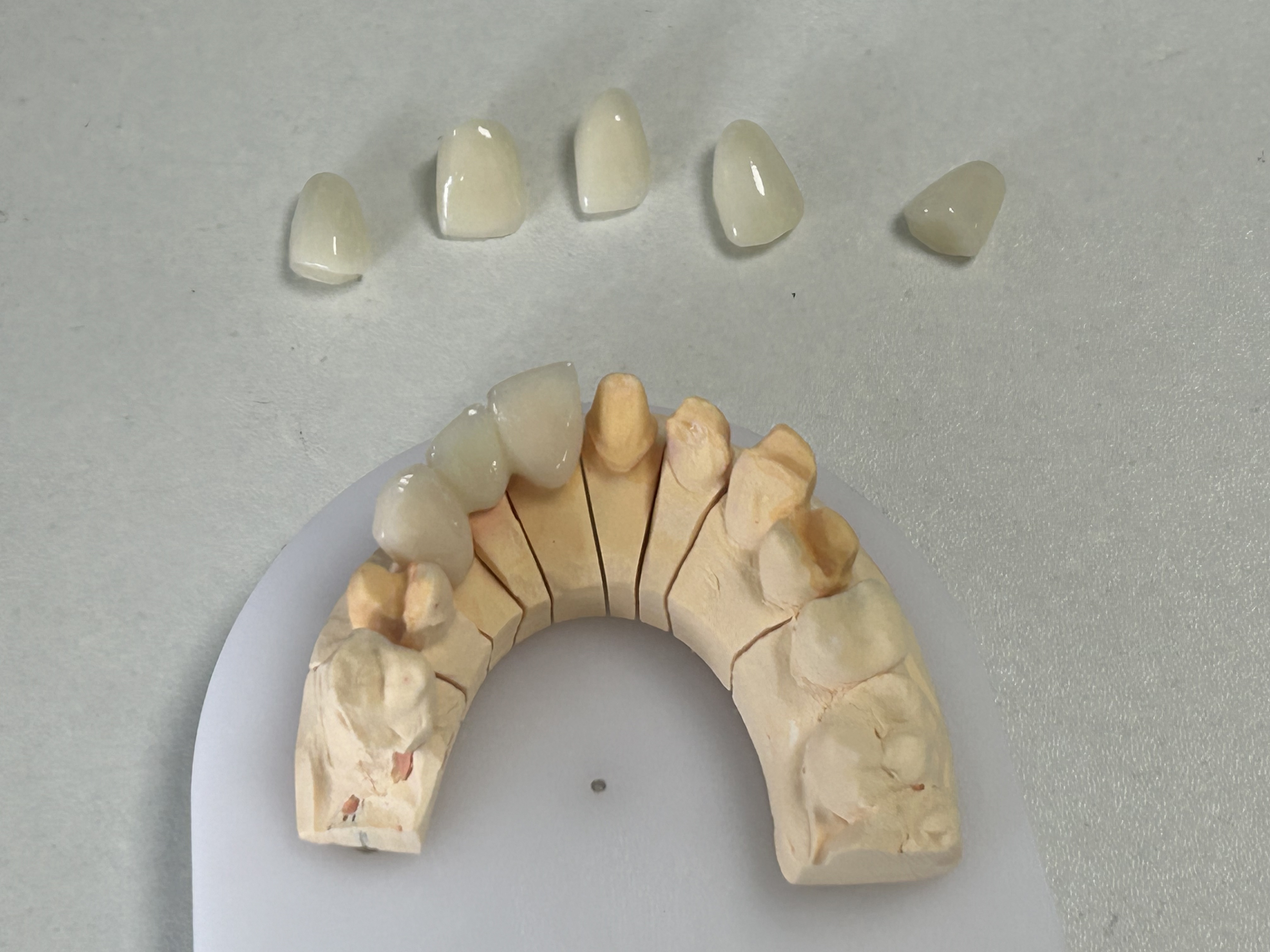 Quality High Strength Full Zirconia Teeth with Natural Aesthetic from ShenZhen Dental Lab for sale