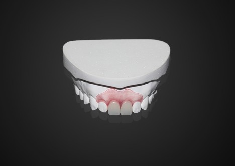 Valplast denture