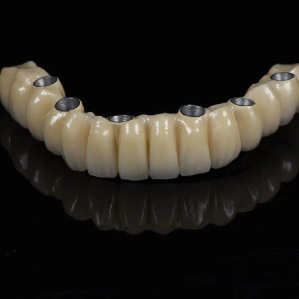 Quality All On 6 PFM Titanium Bridge Dental Crown Full Arch Implant for sale