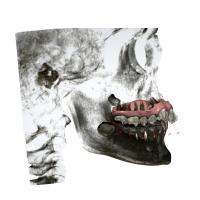 Quality Customized Rubber Fixed Orthodontic Appliances Easy Maintain for sale