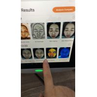Quality Smart Skin Analyzer for sale