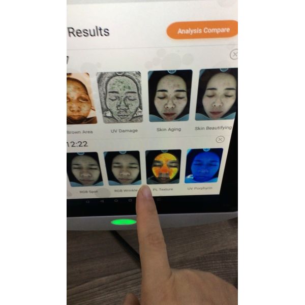 Quality Therapist Smart Skin Analyzer Detect Deep Skin Problem  Ce Certificate for sale