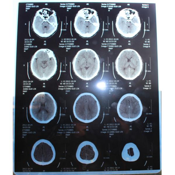 Quality 13x17 Inch Digital X Ray Film for sale