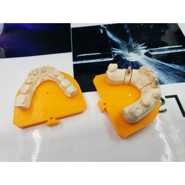 Quality Full Metal PFM Dental Crown Bridge High Tech Biological Material for sale