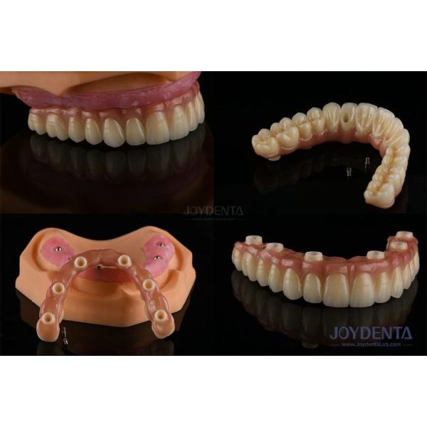Quality Ivoclar Implant Ball Attachments Removable Dental Implant Material For Oral Hygiene for sale