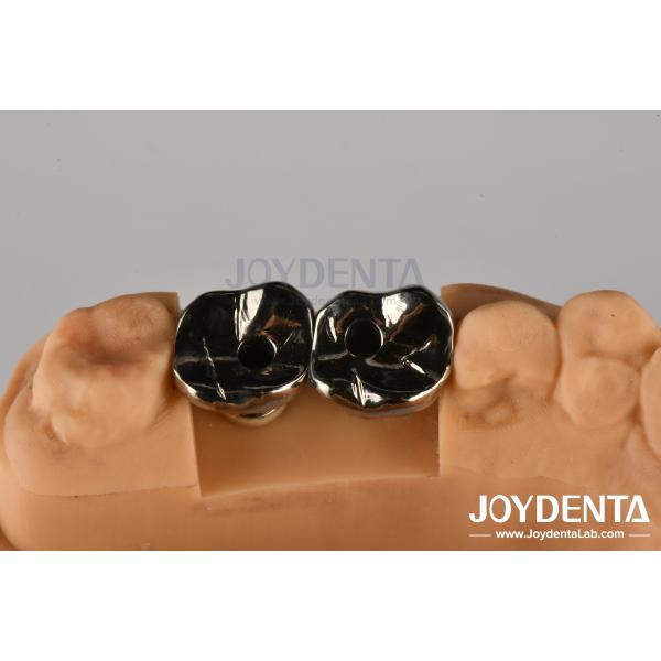 Quality Single Or Multiple Restorations Dental Abutments And Bars With Internal Hex for sale