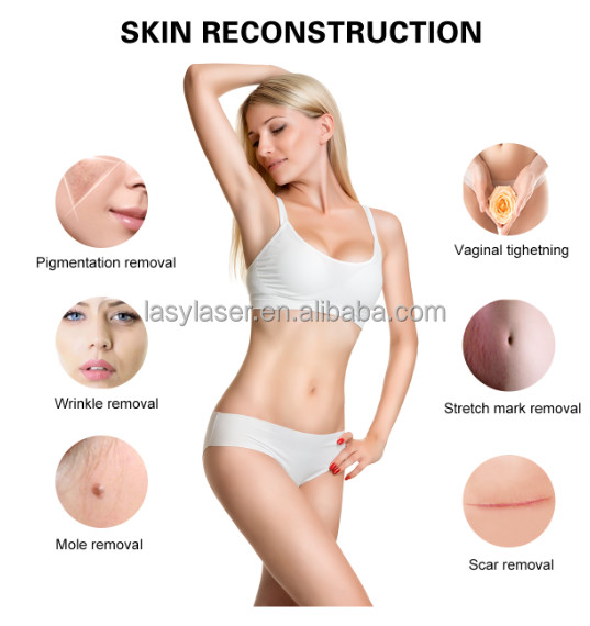 Quality 635nm Vaginal Co2 Laser Resurfacing Machine , Ultrapulse Vigina Tightening for sale