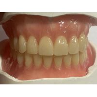 Quality Hypoallergenic Customized Removable Partial Denture With Pink Gum Color for sale