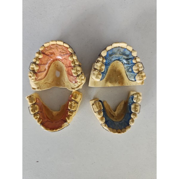 Quality Custom Molded Hawley Retainer with Adjustable Wire for Long-lasting Teeth for sale