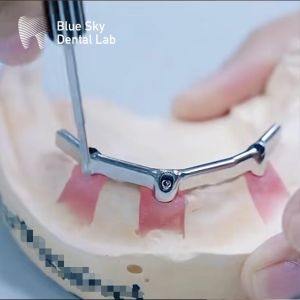 Quality Precision Dental Titanium Bar With Precious Attachment Biocompatible for sale