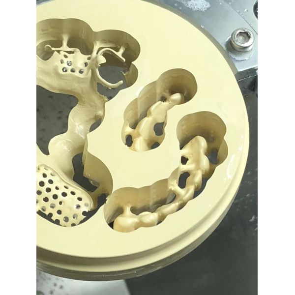 Quality CAD CAM PEEK Partial Denture Framework 3Shape Exocad Denture Design for sale