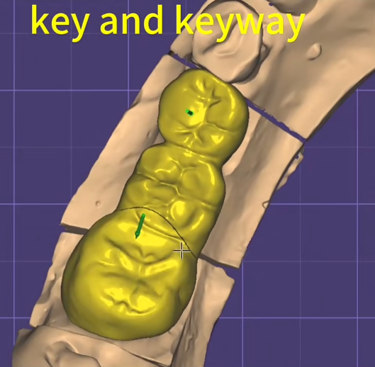 Quality Key and Keyway for Common Path of Insertion with Precision Fit and Durable for sale