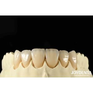 Quality Bionic Development Leaves And Distinct Layers Of Zirconia All-Ceramic for sale