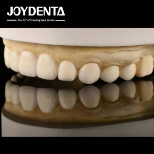 Quality Dental Biomimetic Aesthetic Diagnostic Wax-Up Of Veneers for sale