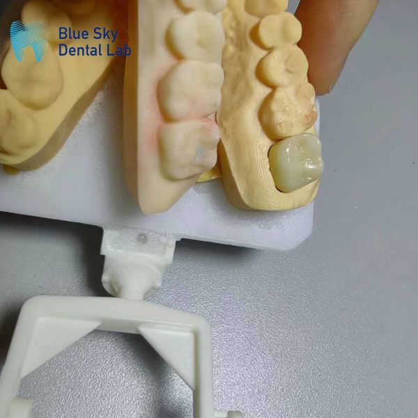 Quality Corrosion Resistant Zirconia Crowns Natural Looking Zirconia Teeth for sale