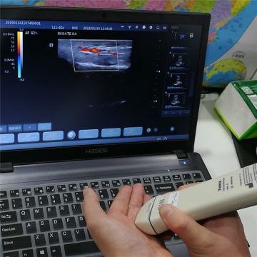 Quality Portable Color Doppler Machine Handheld Ultrasound Scanner With Frequency 2 for sale