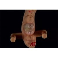 Quality Natural Looking Crown Composite Inlay Onlay Onlay Inlay Dental OEM for sale