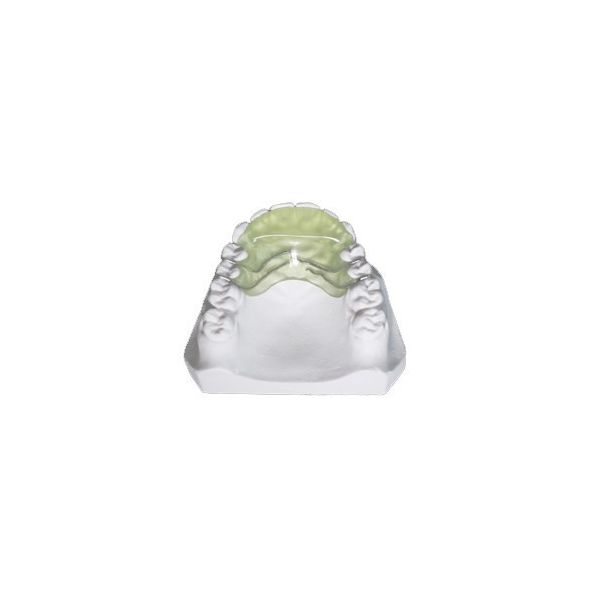 Quality Customized Orthodontic Functional Appliance Removable Flat Guide Plane for sale
