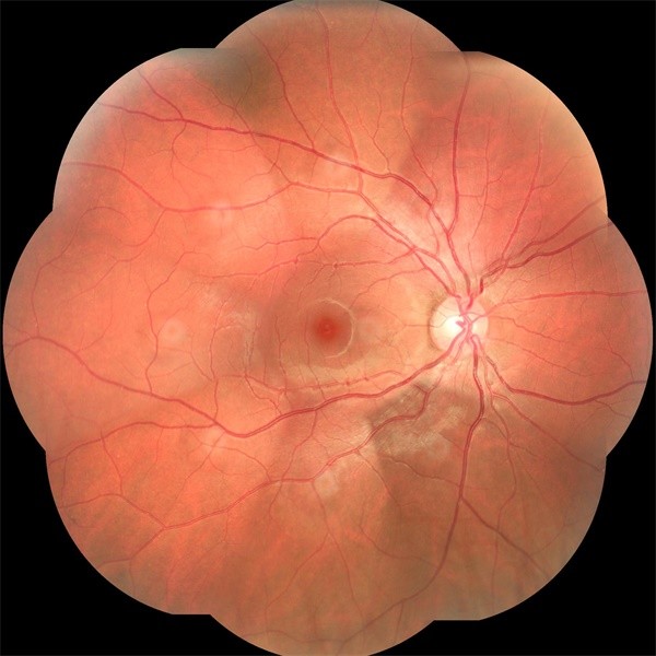 Quality OCT Automated Fundus Camera High Resolution For Choroid for sale