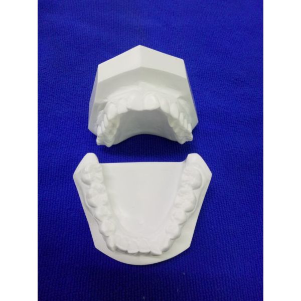 Quality Dental Study Model with CAD CAM Digital Design and 3D Printing Workflow for for sale