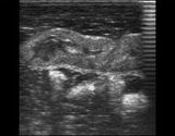 Quality Mini Veterinary Ultrasound Scanner for sale