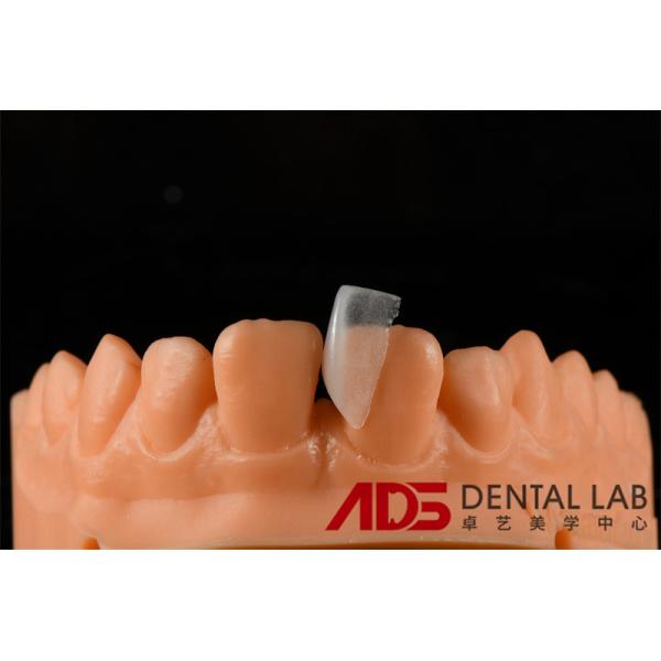 Quality Dentures Aesthetic Emax All Ceramic Crowns Front Teeth OEM for sale