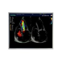 Quality LB190E02-SL01 LG 19" IPS TFT LCD Panel for Industrial Application for sale