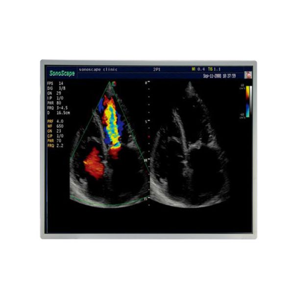 Quality LB190E02-SL01 LG 19