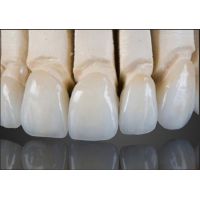 Quality Wieland Zirconia All Ceramic Crown Inner Painting Customized With CAD Design for sale